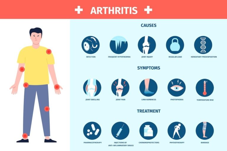 The Three Most Common Types of Arthritis | Diagnosis - FAQ about ...
