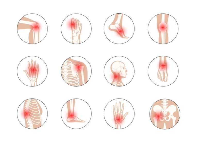 Are there different types of arthritis? - Medkart Pharmacy Blogs