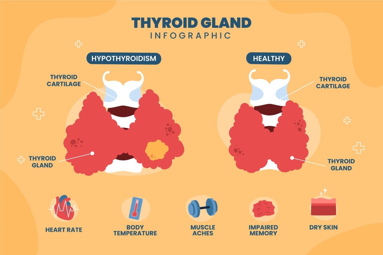 Hypothyroidism Treatment: Hypothyroidism Natural Treatment
