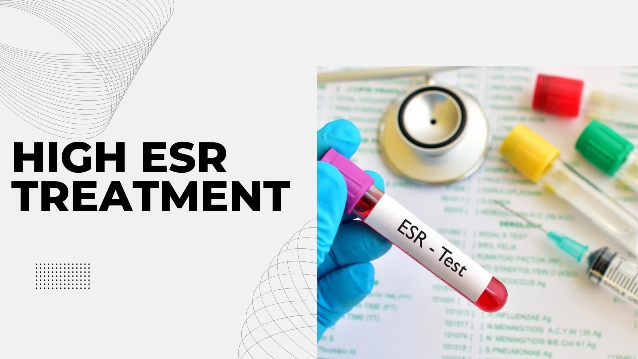 High ESR Treatment: Causes and Effective Treatment Options