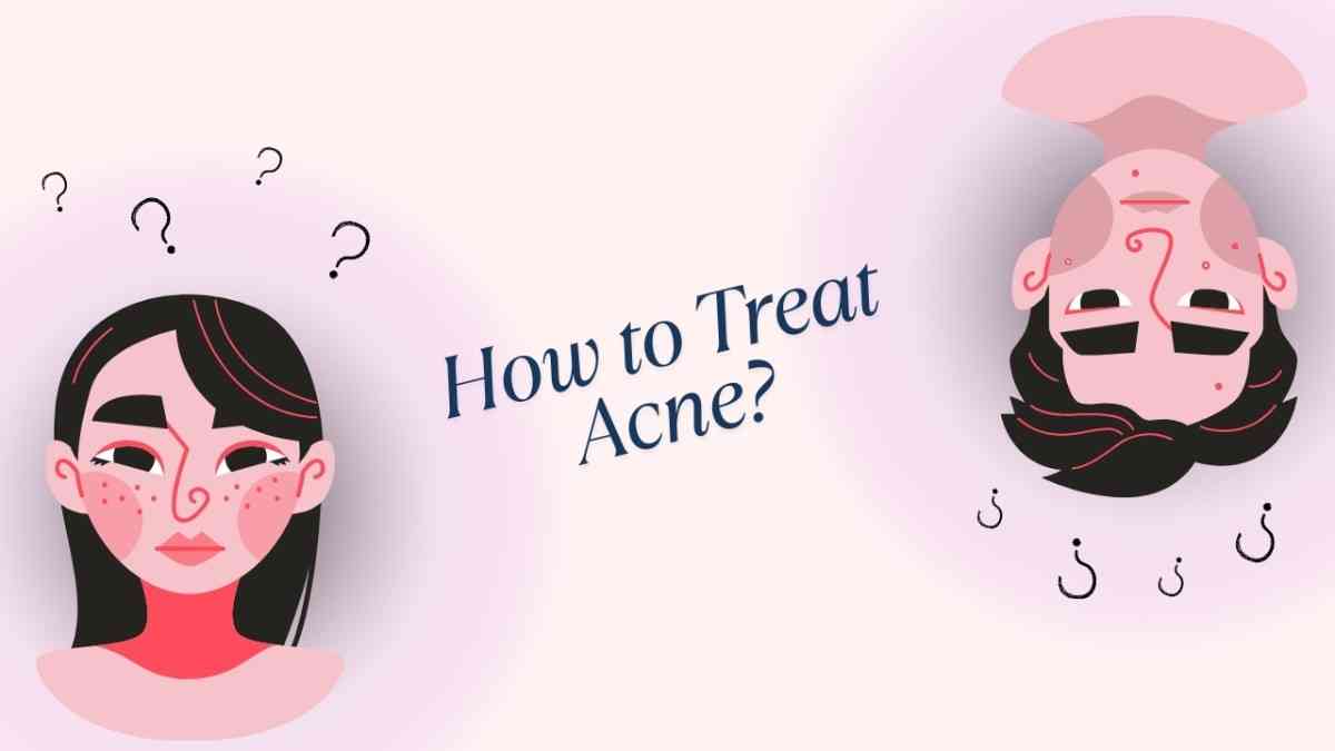 Pimple Treatment - How to Treat Acne? Causes, Pimple Prevention
