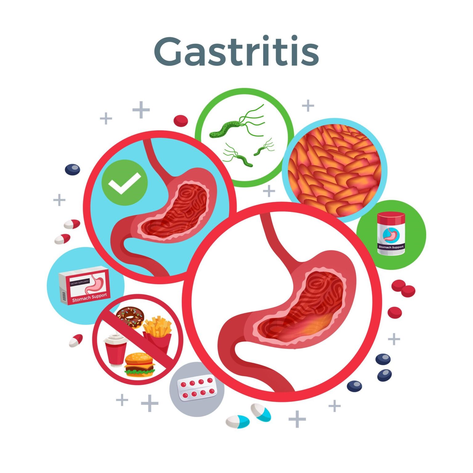 Gastritis Treatment - Best Treatment for Gastritis