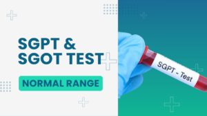 Danger Level of SGPT and SGOT - Normal Range