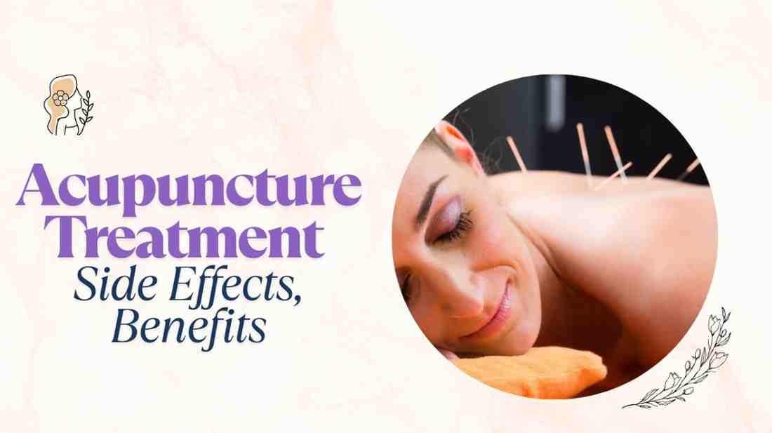 Acupuncture Treatment - Side Effects, Benefits of Acupuncture