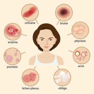 Preventing Skin Infections: Tips for Healthy Skin - Medkart Pharmacy Blogs