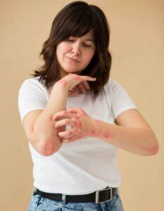 Preventing Skin Infections: Tips for Healthy Skin - Medkart Pharmacy Blogs