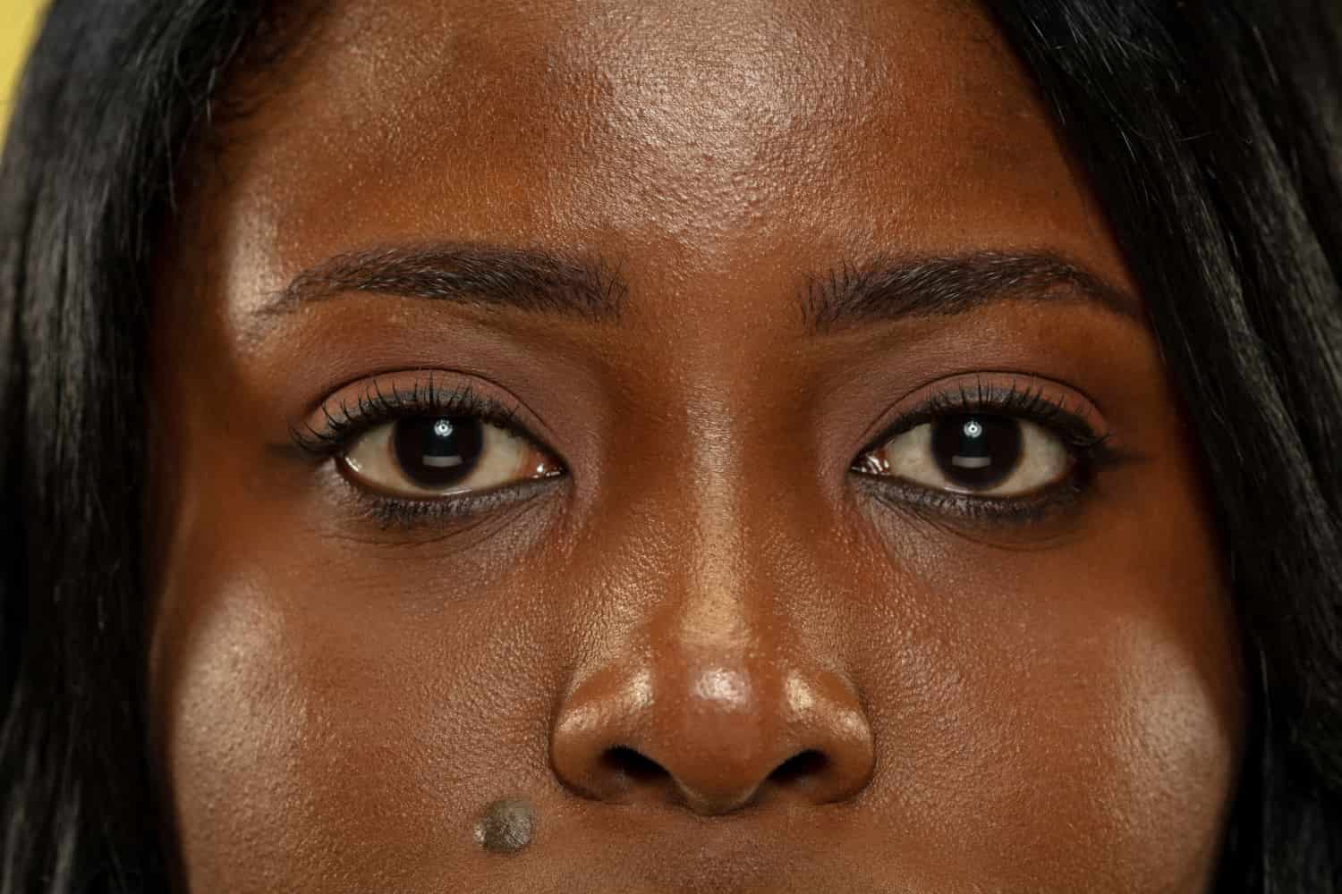 How to Reduce Melanin, Which Controls Pigmentation for Lighter Skin ...